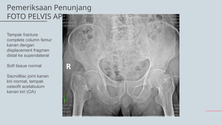 laporan kasus Close Fracture collum dextra | PPTX