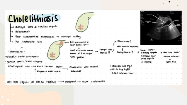 Lapsus_Choledocolithiasis + Cholesistitis_Syahda Nabilla Aristawidya.pptx