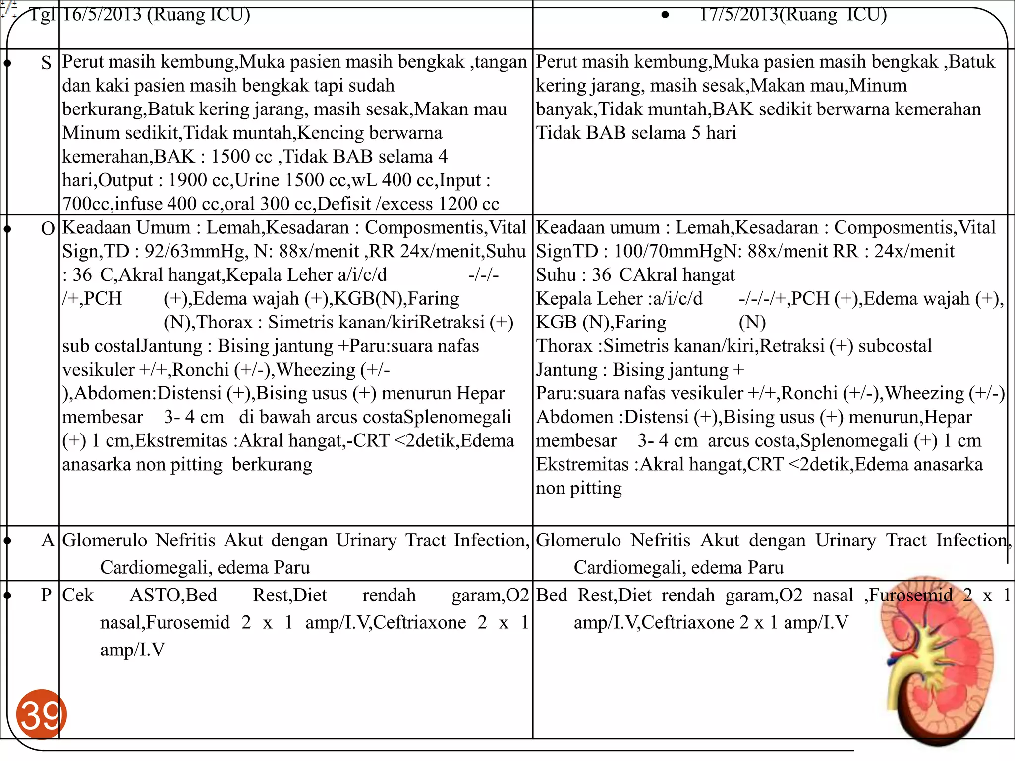 glomerulonefritis anak | PPTX