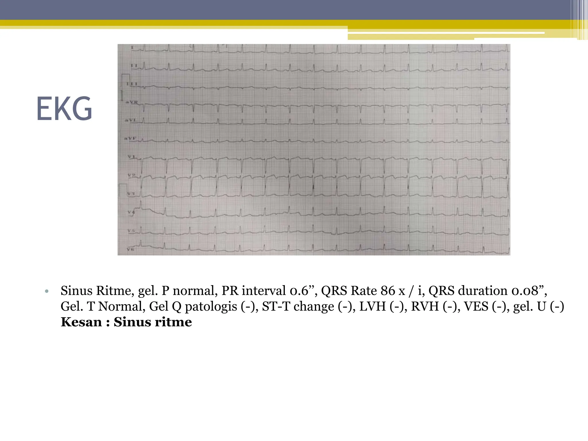 Lapsus kasus Hepatoma Irvan.pptx NEW.pptx