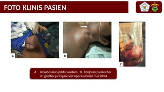 LAPSUS HOM REVISI animasi all about case report | PPT