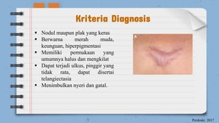 LAPSUS KELOID.pptx
