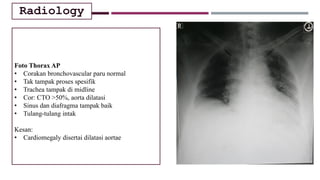 Kesadaran Menurun ec Hemoragik Stroke | PDF