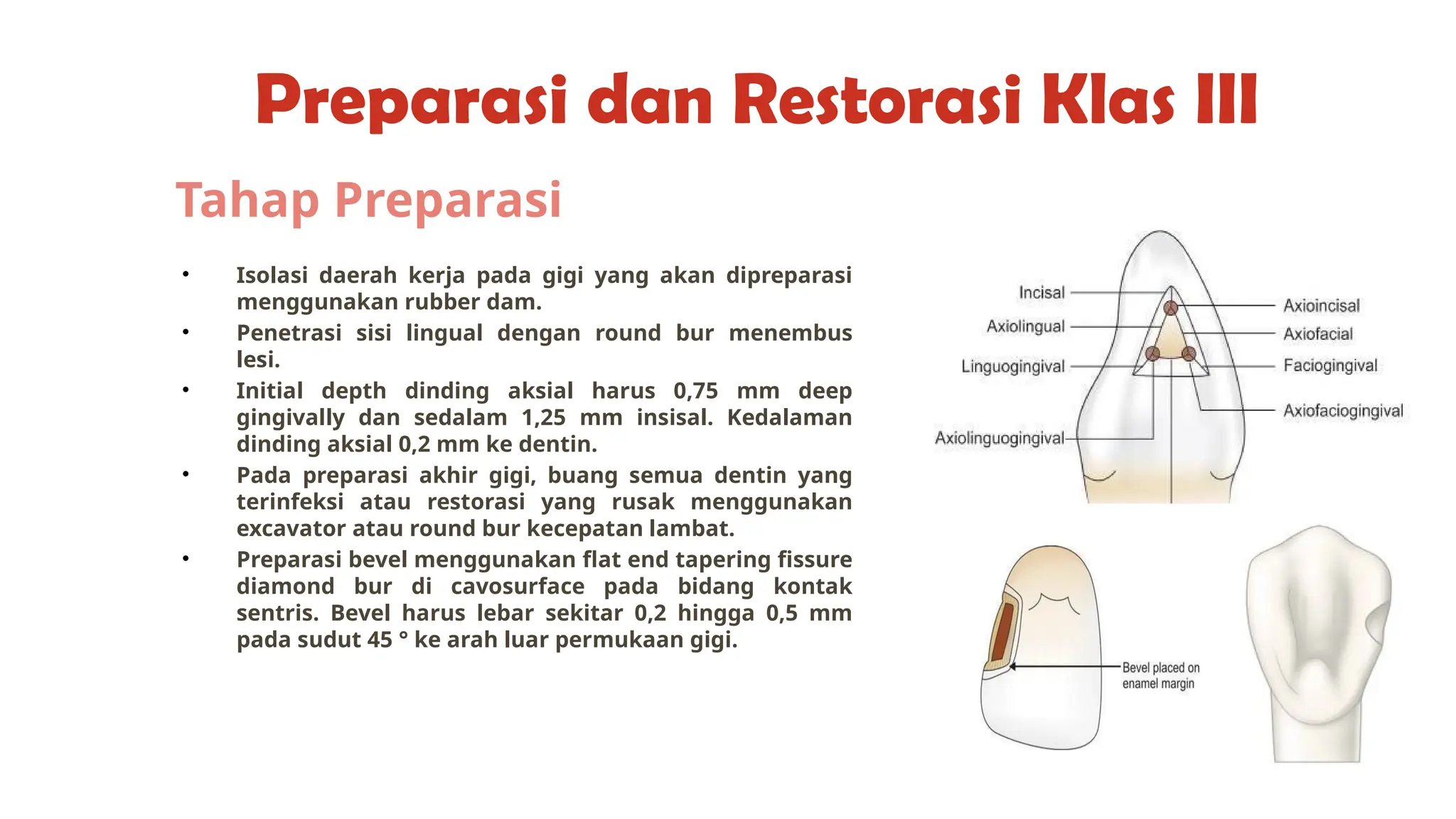 LAPSUS RESTORASI KOMPOSIT KLAS III GIGI 21.pptx