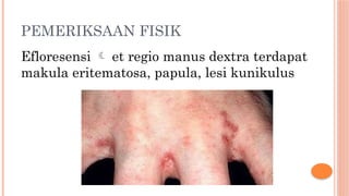 Lapsus SCABIES ilmu kesehatan kulit.pptx