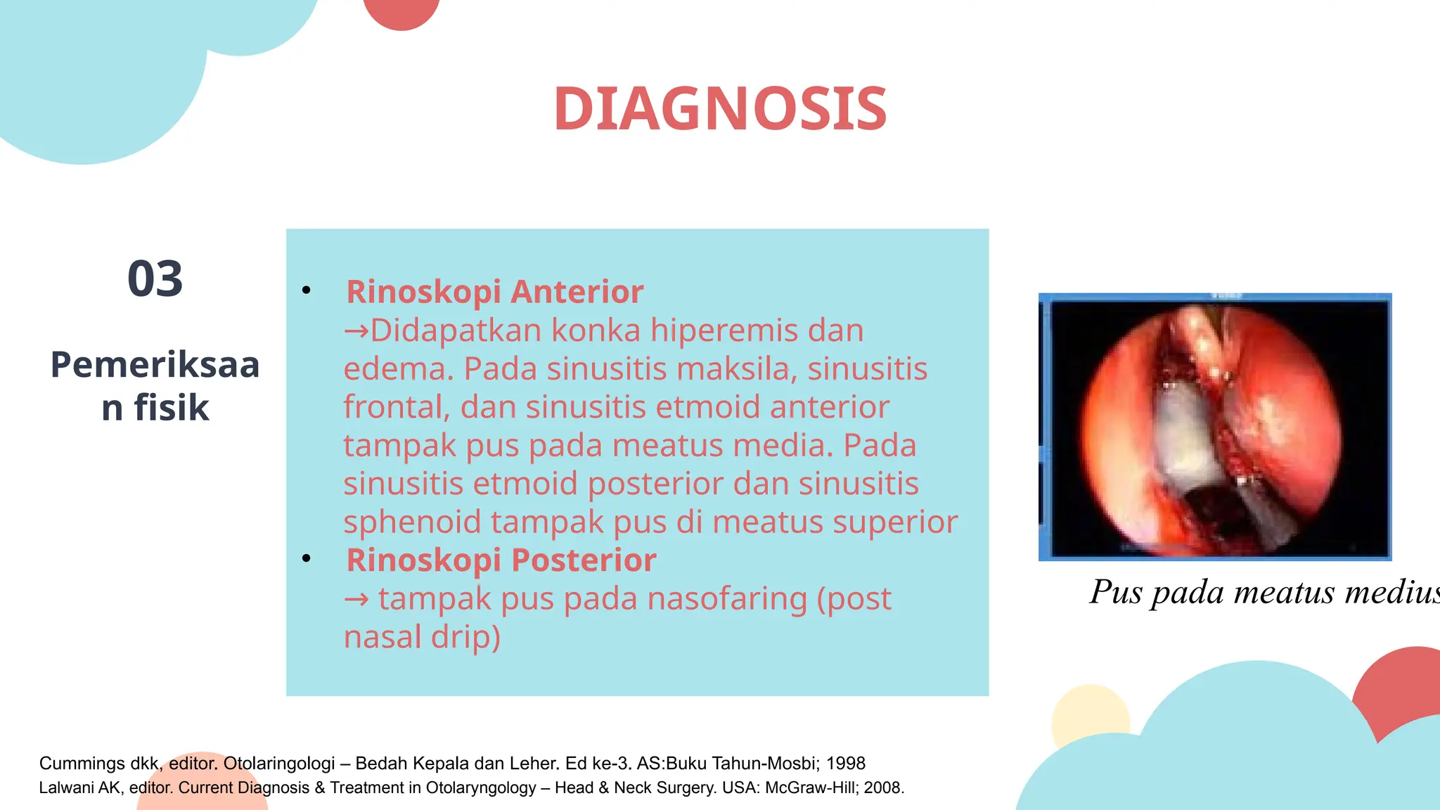 Lapsus risyay SINUSITIS -2.pptx nnnnnnnnn | PPT