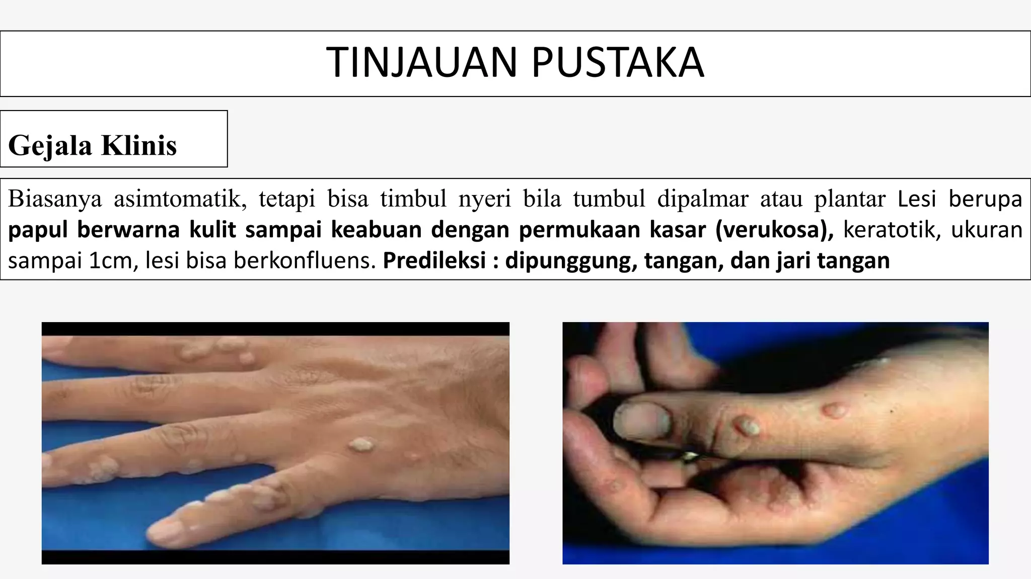 Veruka vulgaris | PPTX