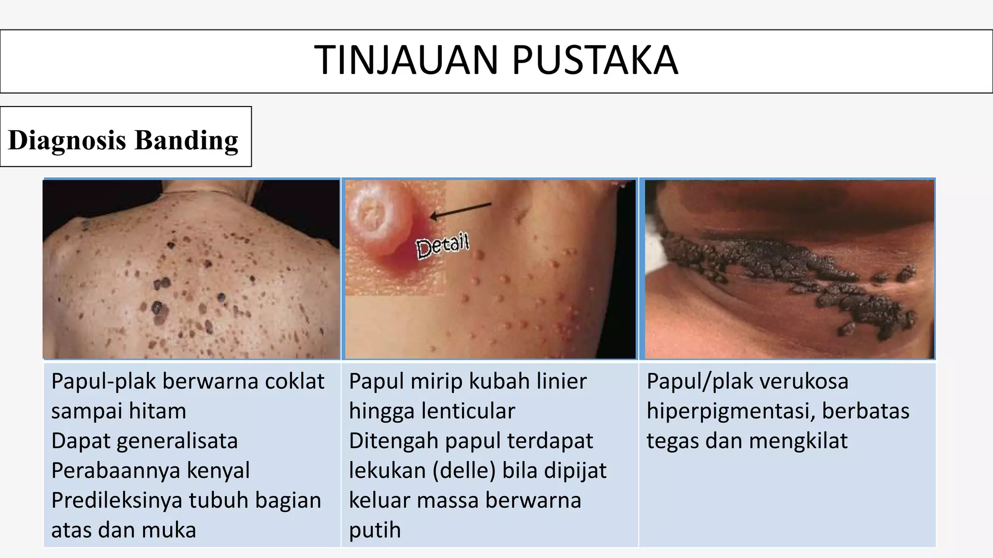 Veruka vulgaris | PPTX