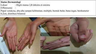 Veruka vulgaris | PPTX