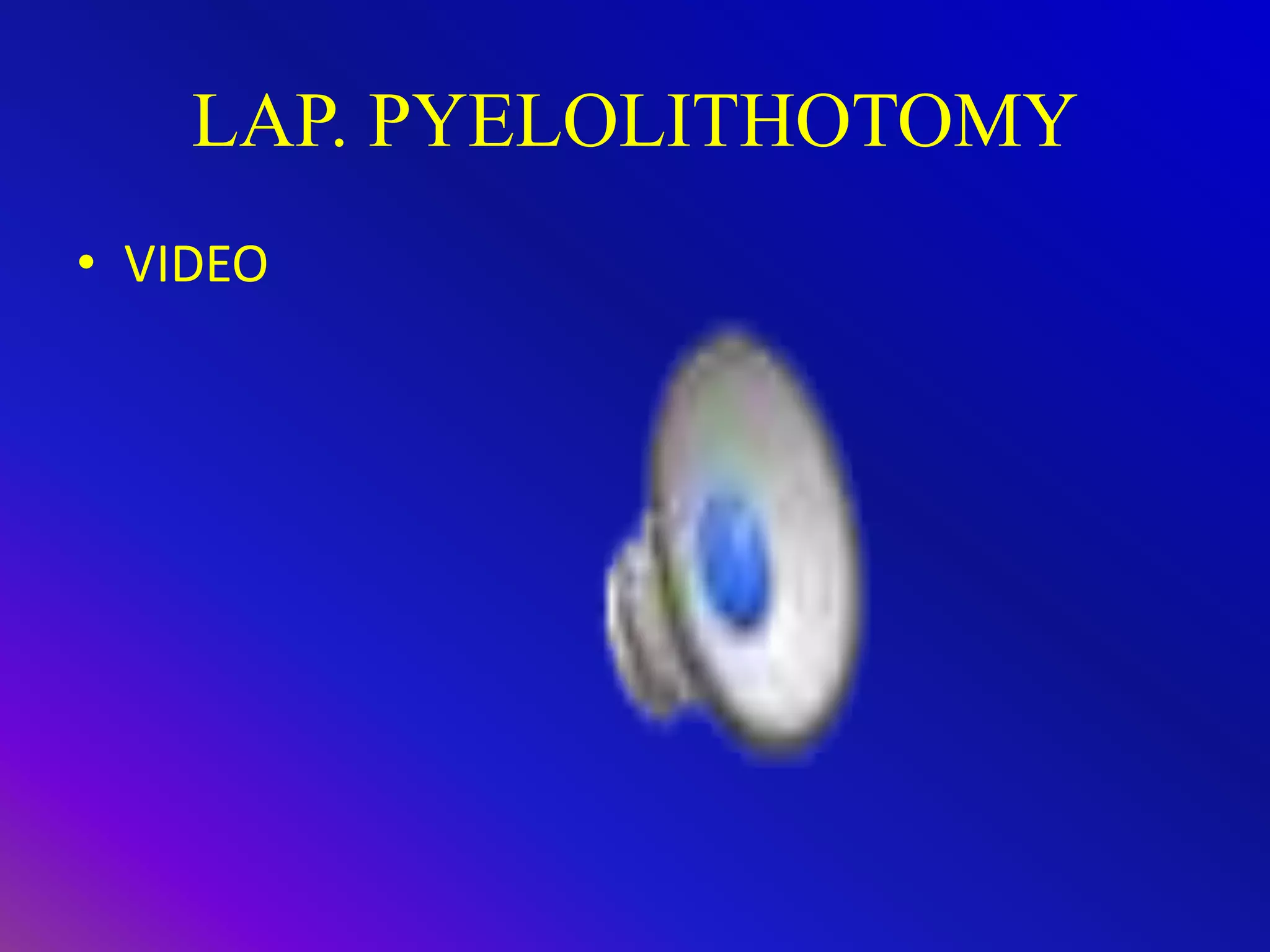LAPAROSCOPIC UROLOGICAL SURGERY | PPTX