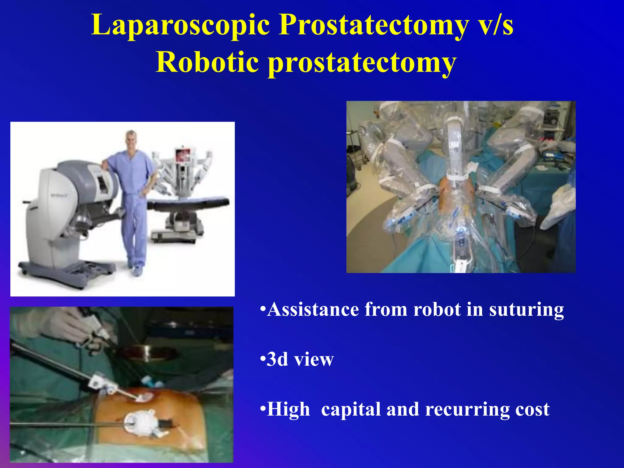 LAPAROSCOPIC UROLOGICAL SURGERY | PPTX