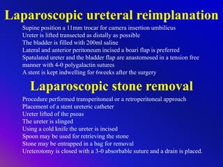 LAPAROSCOPIC UROLOGICAL SURGERY | PPTX