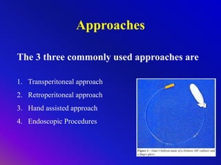 LAPAROSCOPIC UROLOGICAL SURGERY | PPTX