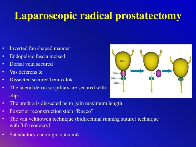 LAPAROSCOPIC UROLOGICAL SURGERY