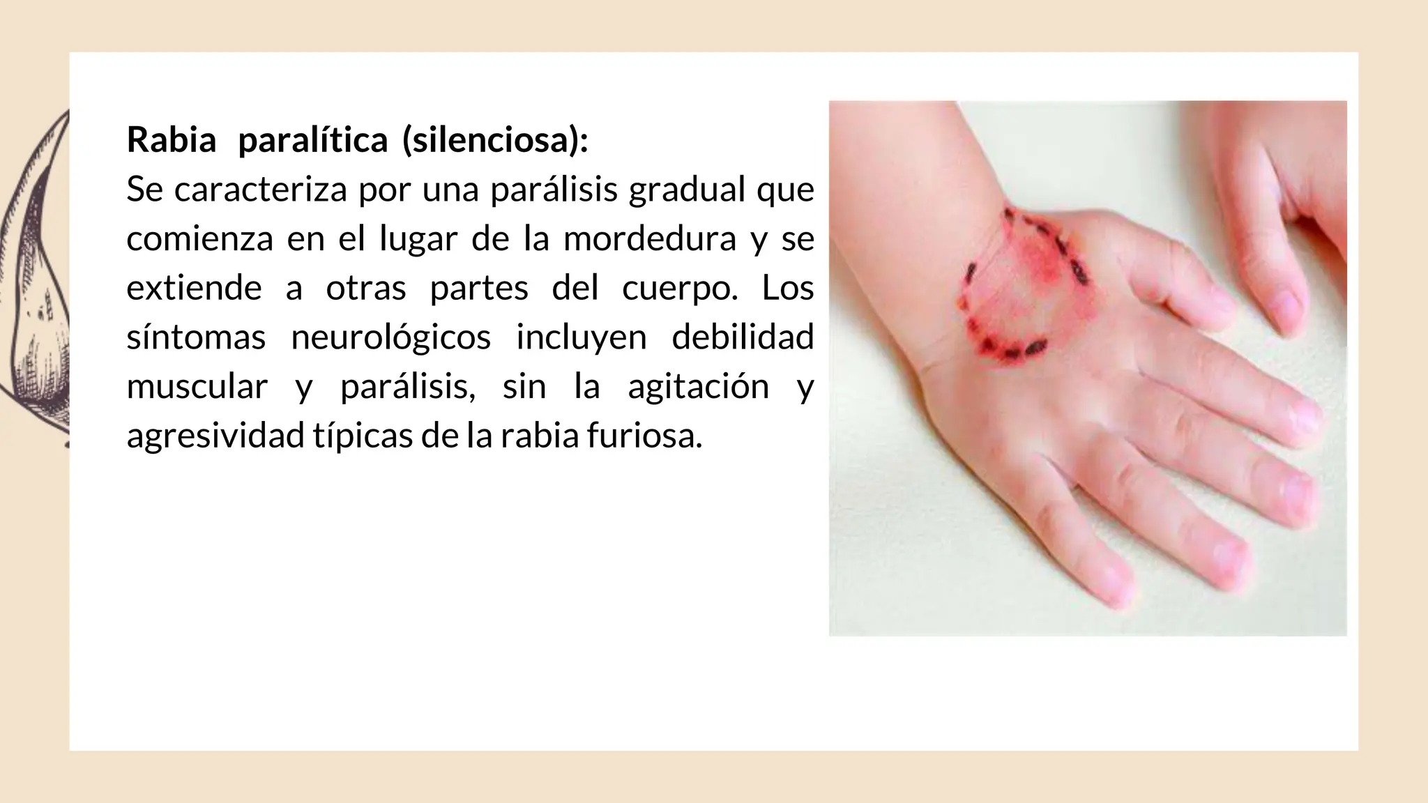 la rabia .pptx materia de nuerologia harrison | PPTX