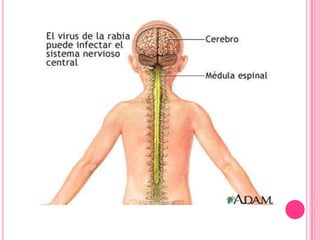 La rabia | PPTX