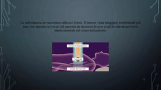 La radioterapia a fotoni.pptx