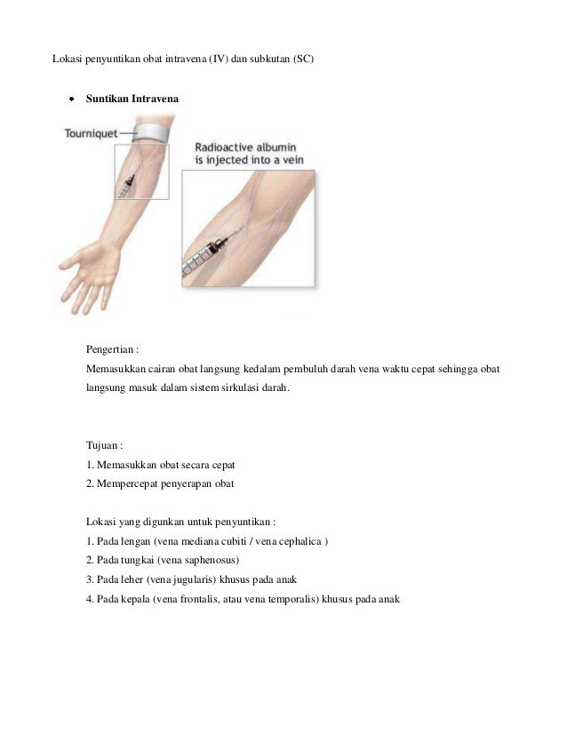 La rangki injeksi intravena n subkutan