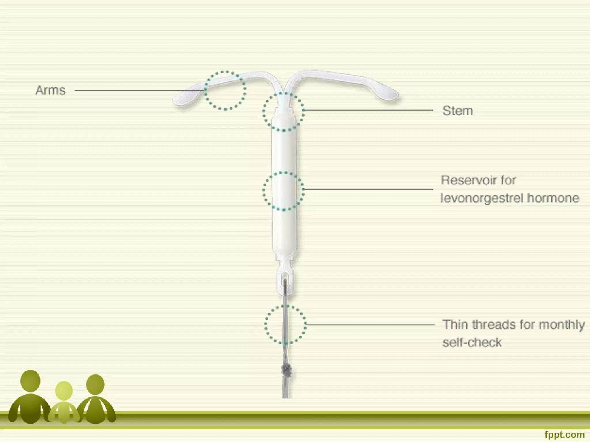 Long acting reversible contraception | PPTX