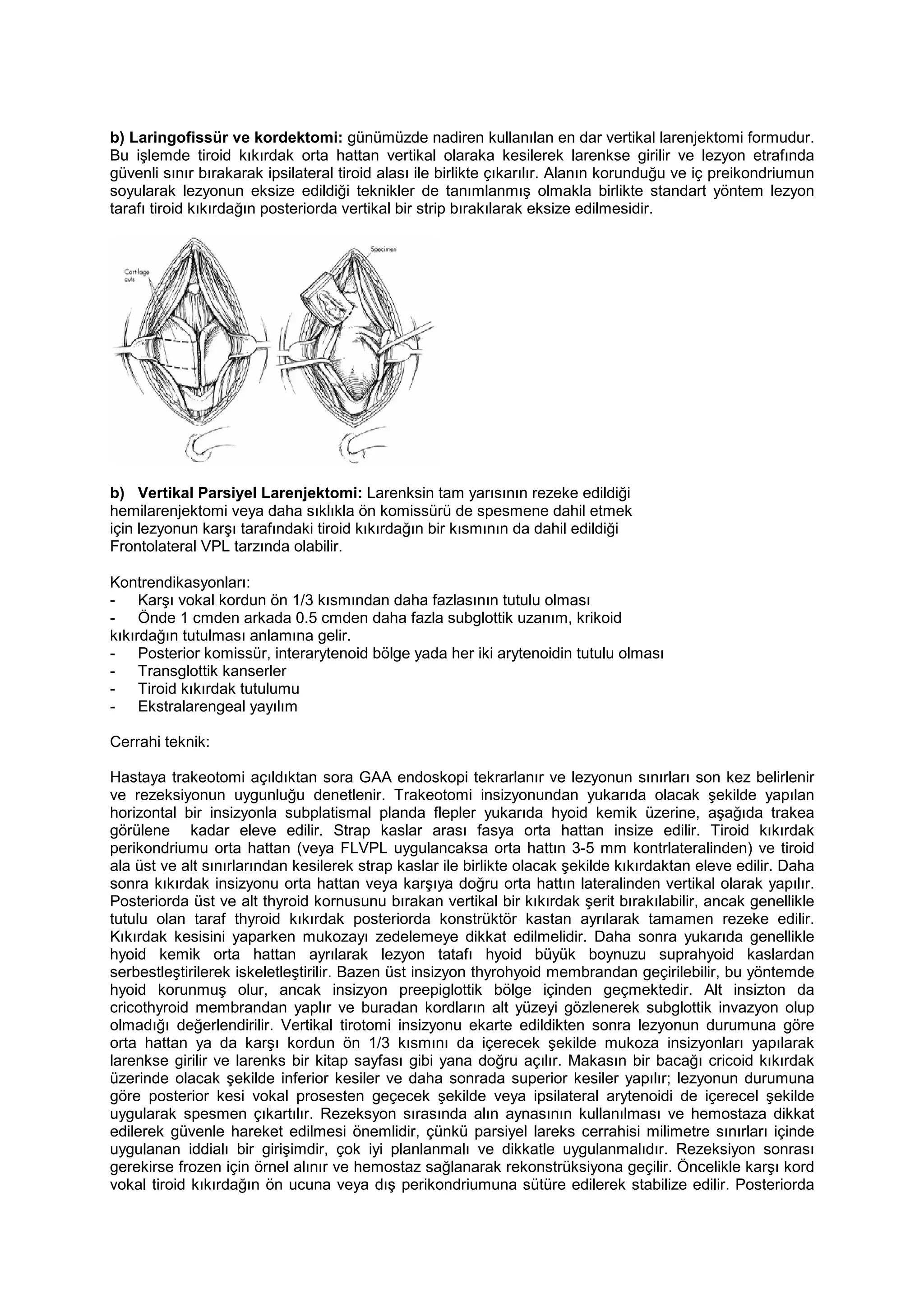 Larenks cerrahisi | PDF