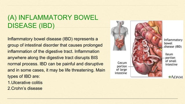 Disorders related to large intestine | PPTX