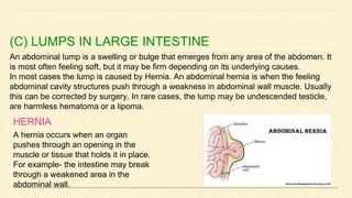 Disorders related to large intestine | PPTX