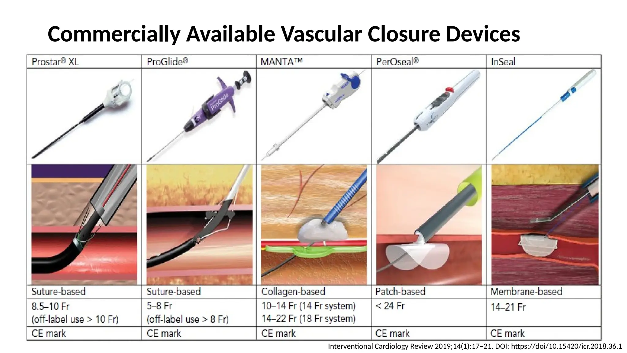 Large bore access in cardiology very imp | PPTX