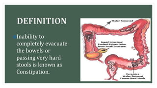 Large bowel disorders | PPT