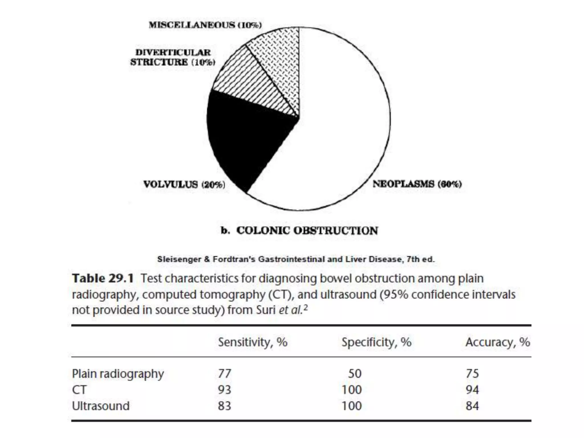 Large bowel obstruction | PPTX