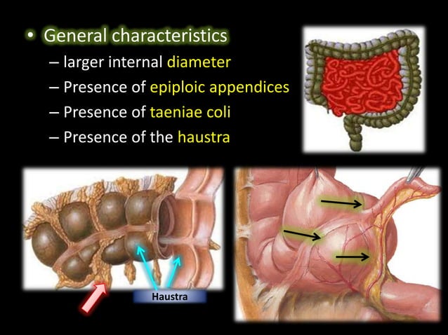 Large bowel obstruction | PPTX | Digestive Disorders | Diseases and ...