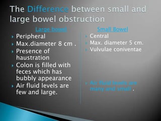 Large bowel obstruction | PPTX