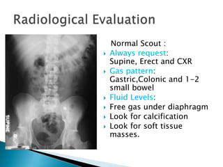 Small Bowel Obstruction X Ray