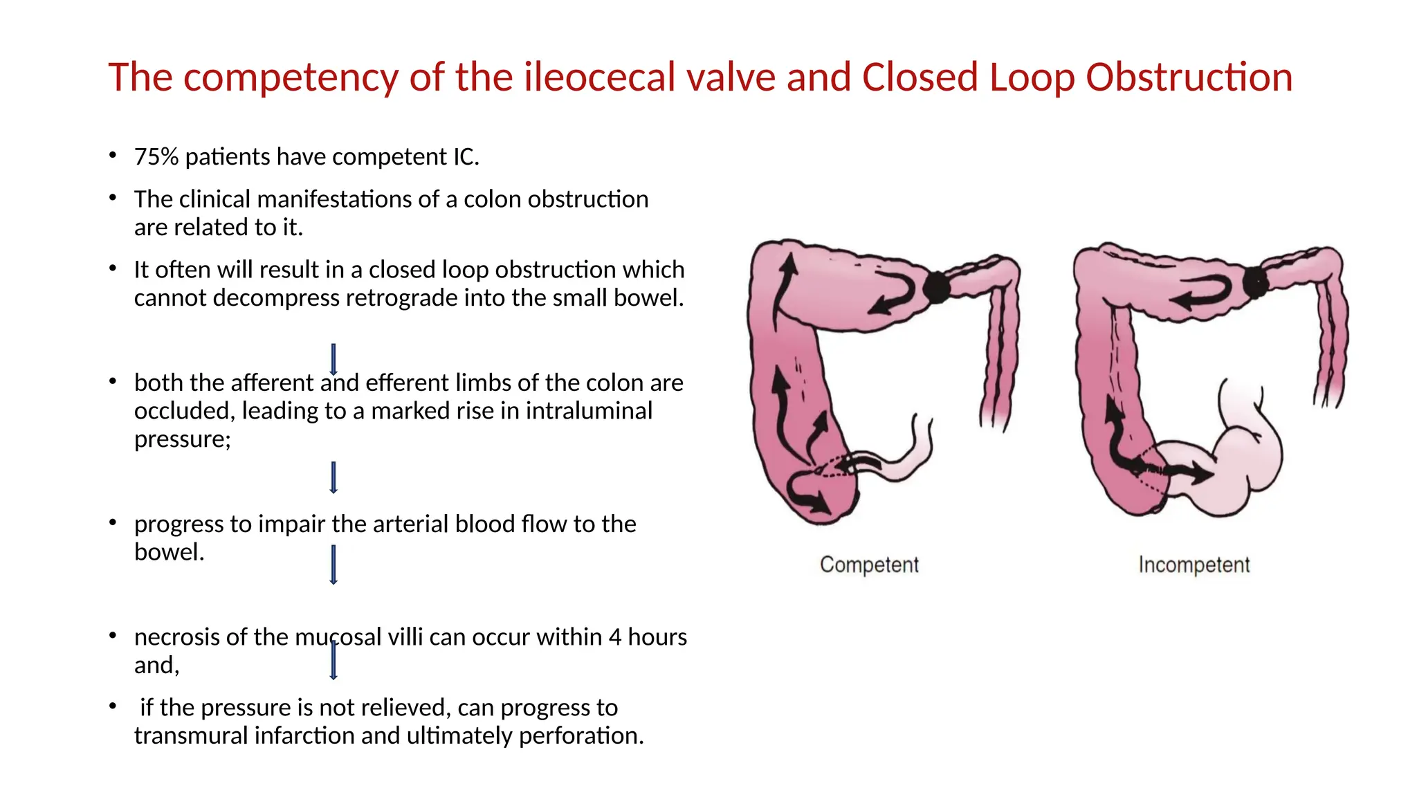 Large Bowel Obstruction- Evaluation and Management .pptx