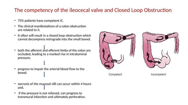 Large Bowel Obstruction- Evaluation and Management .pptx