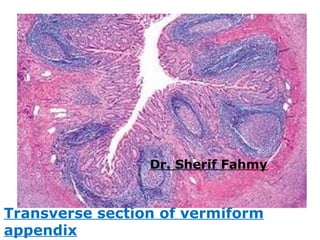 Large Intestines (Anatomy of the Abdomen) | PPS