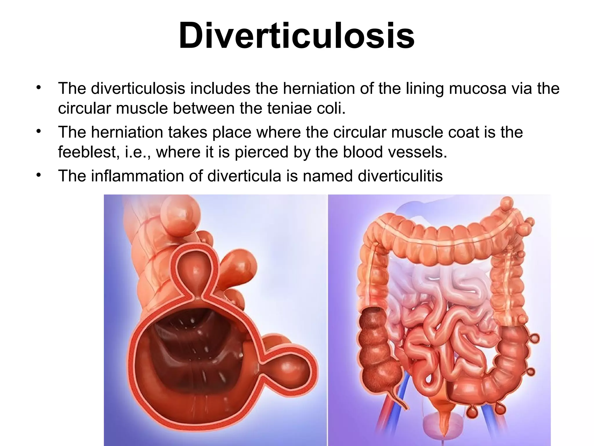 Large intestine .pdf