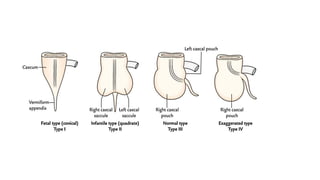 Anatomy of the human Large intestine.pptx