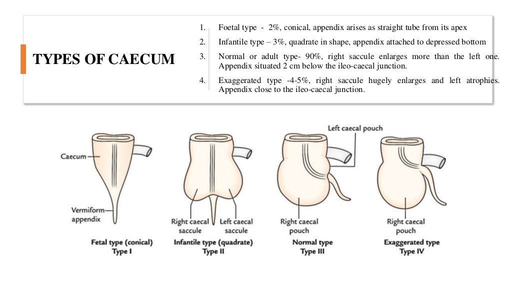 Large intestine , Caecum and Appendix.pptx