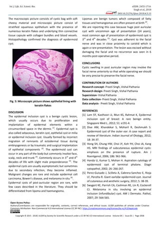 Large Post Auricular Epidermal Inclusion Cyst Involving Facial Nerve- A ...
