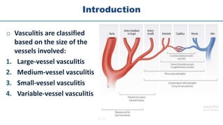 Large Vessel Vasculitides - Issa Aldababseh.pptx