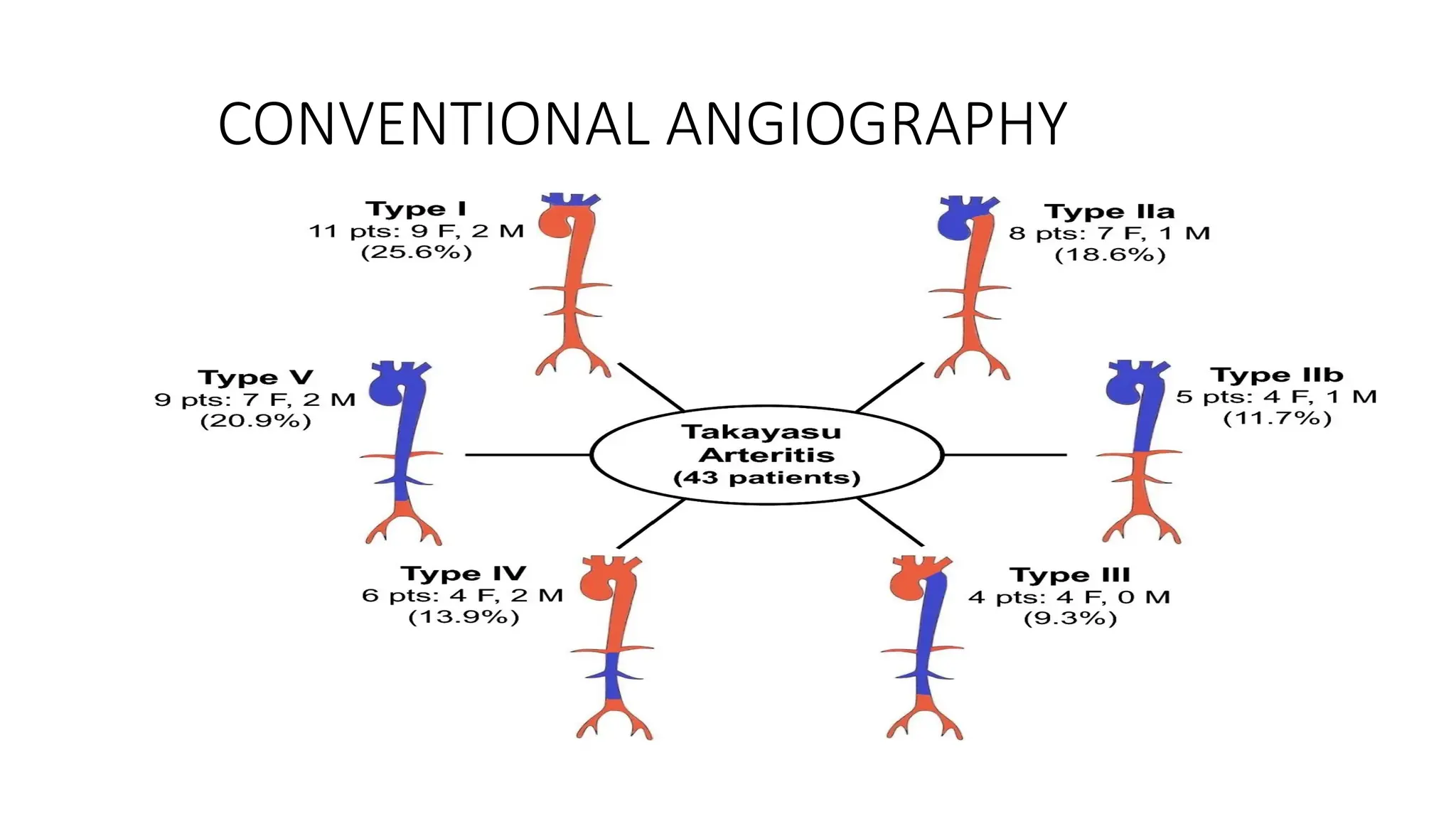 LARGE VESSEL VASCULITIS- gca, takayasu arteries | PPTX
