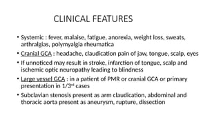 LARGE VESSEL VASCULITIS- gca, takayasu arteries | PPTX