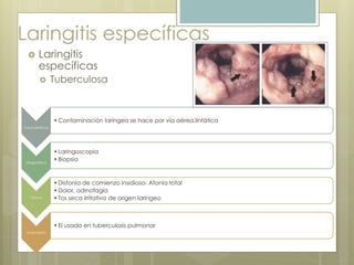 Laringitis | PPTX