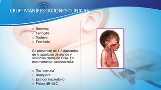 Laringitis PEDIATRIA | PPTX