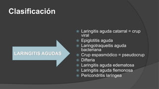 Laringitis traqueitis | PPTX