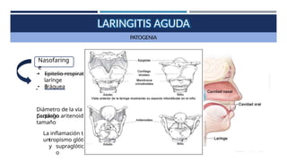 Laringitis Aguda por infección bacteriana y viral | PPTX