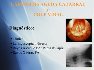 Laringitis Aguda Pre Grado | PPT