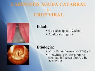 Laringitis Aguda Pre Grado | PPT