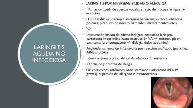 LARINGITIS AGUDA Y CRÓNICA-2.pptx