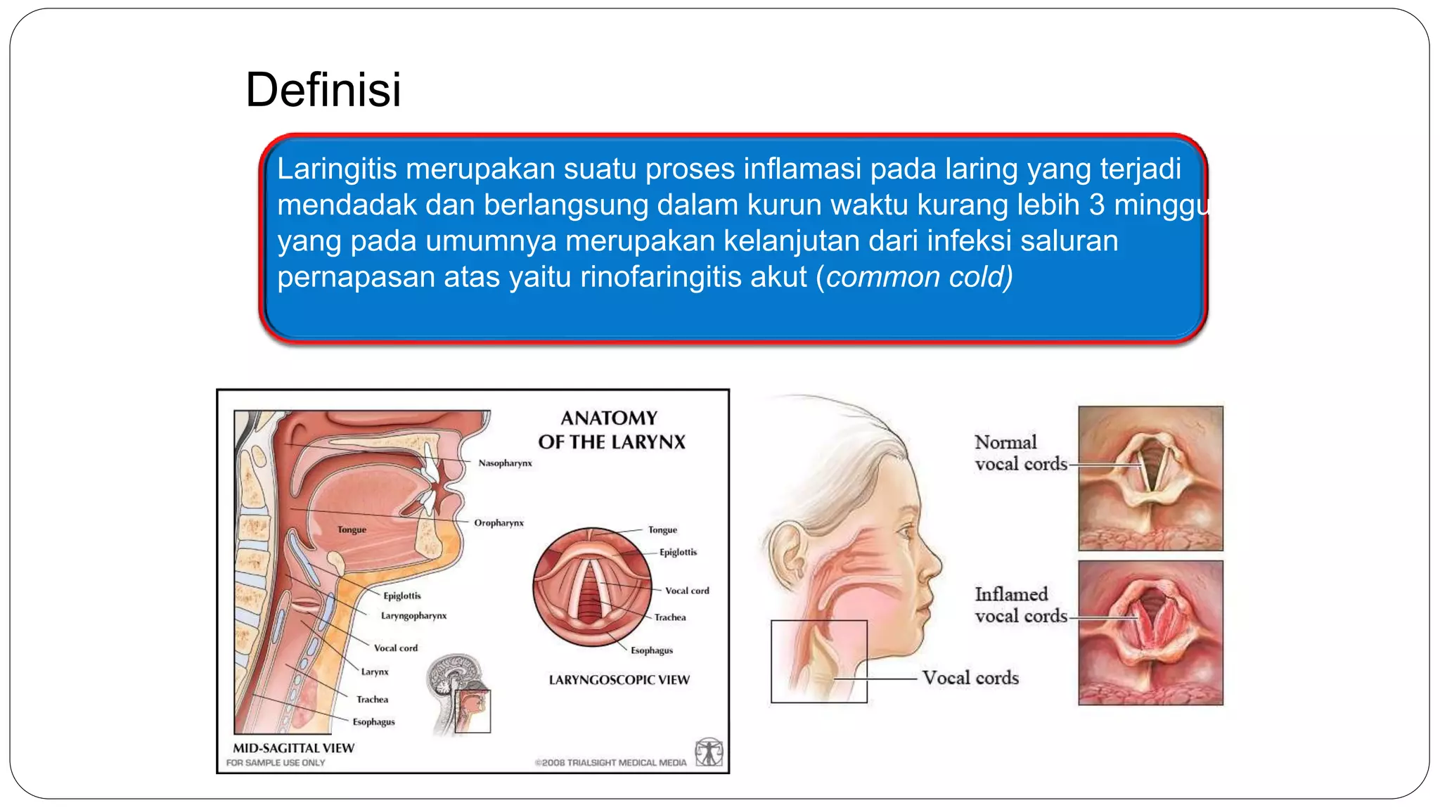 LARINGITIS_AKUT.ppt